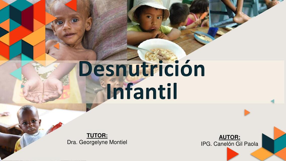 Desnutrición en Pediatría | Paola | uDocz