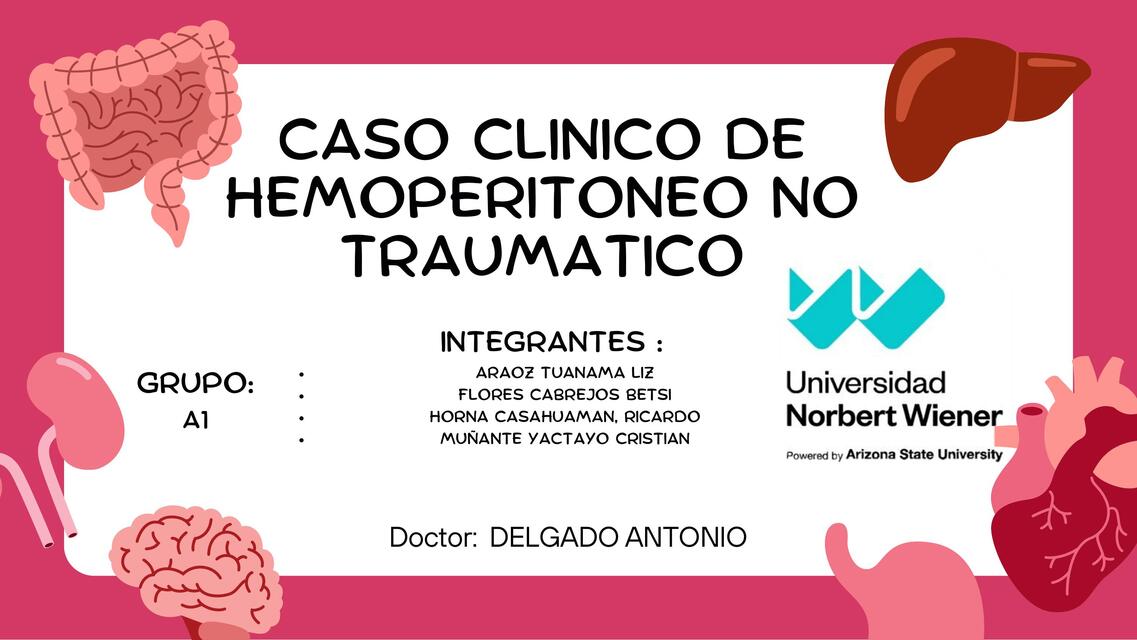 HEMOPERITONEO NO TRAUMATICO | Horna Casahuaman Ricardo | uDocz