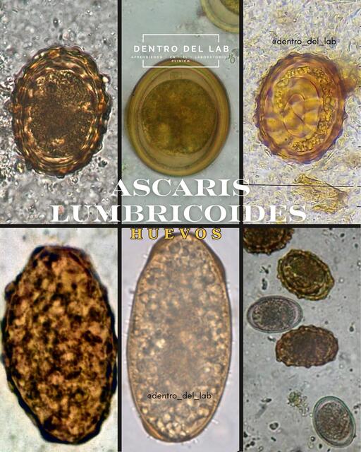 Ascaris lumbricoides (tipos de huevos) | Dentro del lab 🔬🩵 | uDocz