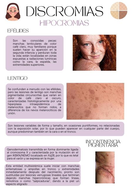 DISCROMIAS | SYDNEY GARIBAY CASTILLO | uDocz