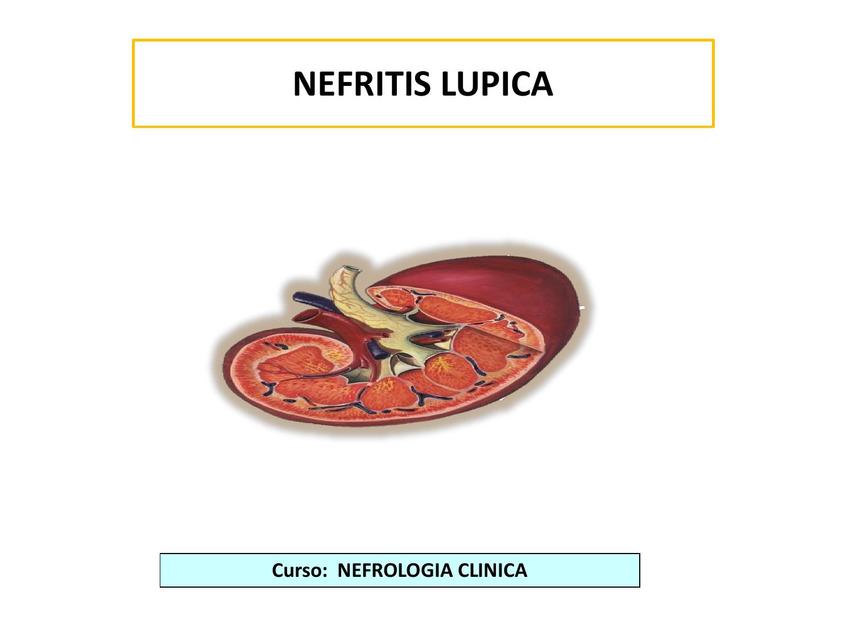 Nefritis Lupica | Ahmed Casana | uDocz