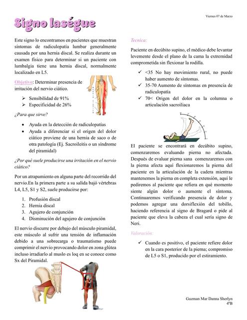 Signo de Laségue | Sherlyn | uDocz