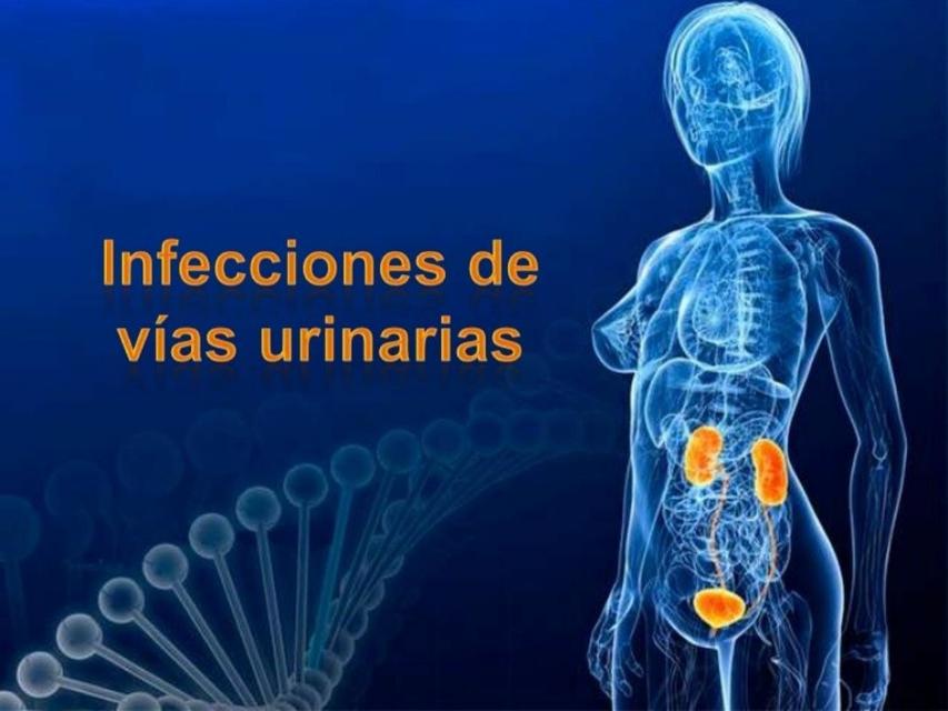 Infección de Vías Urinarias | Todo de Medicina | uDocz