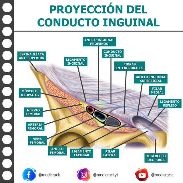 PROYECCIÓN DEL CONDUCTO INGUINAL | Medicrack | uDocz