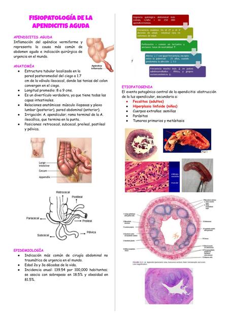 FISIOPATOLOGÍA DE LA APENDICITIS AGUDA | Thalia Paola Caballero Quispe | uDocz