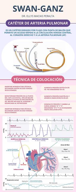 CATETER DE LA ARTERIA PULMONAR SWAN GANZ DR ELLYS | Ellys Macias ...