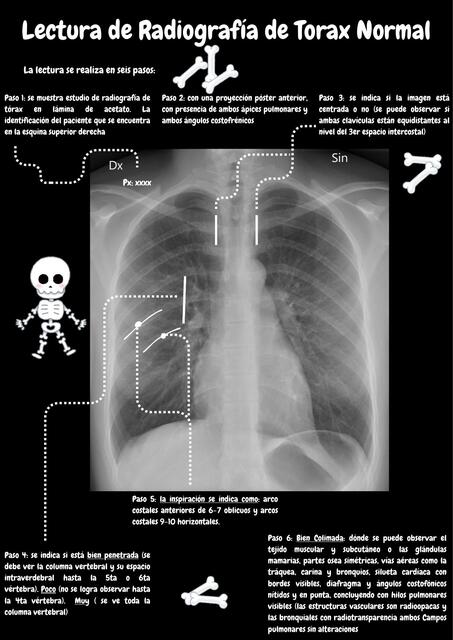 Presentación de Radiografía de Torax Normal | Alejandro Larez | uDocz