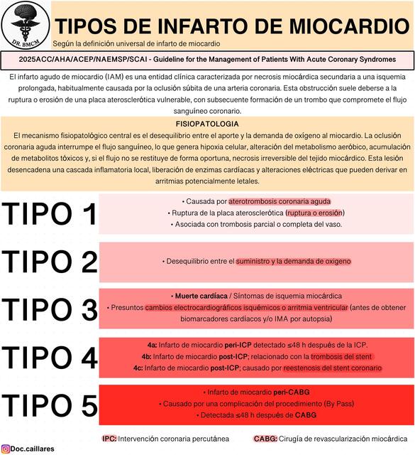 TIPOS DE INFARTO DE MIOCARDIO | Dr. Boris Moises Caillares Montaño | uDocz