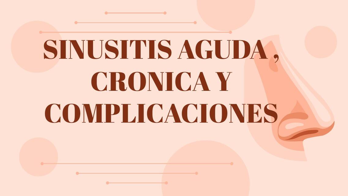SINUSITIS AGUDA CRONICA Y COMPLICACIONES | Jeffrey Loayza Baldellón | uDocz