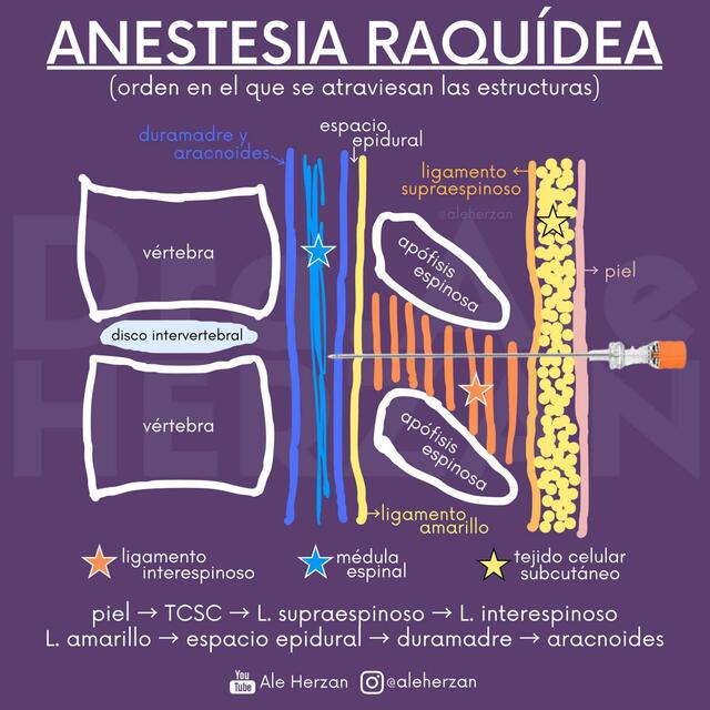 ANESTESIA RAQUÍDEA: capas que se atraviesan para colocarla | Dra Ale ...