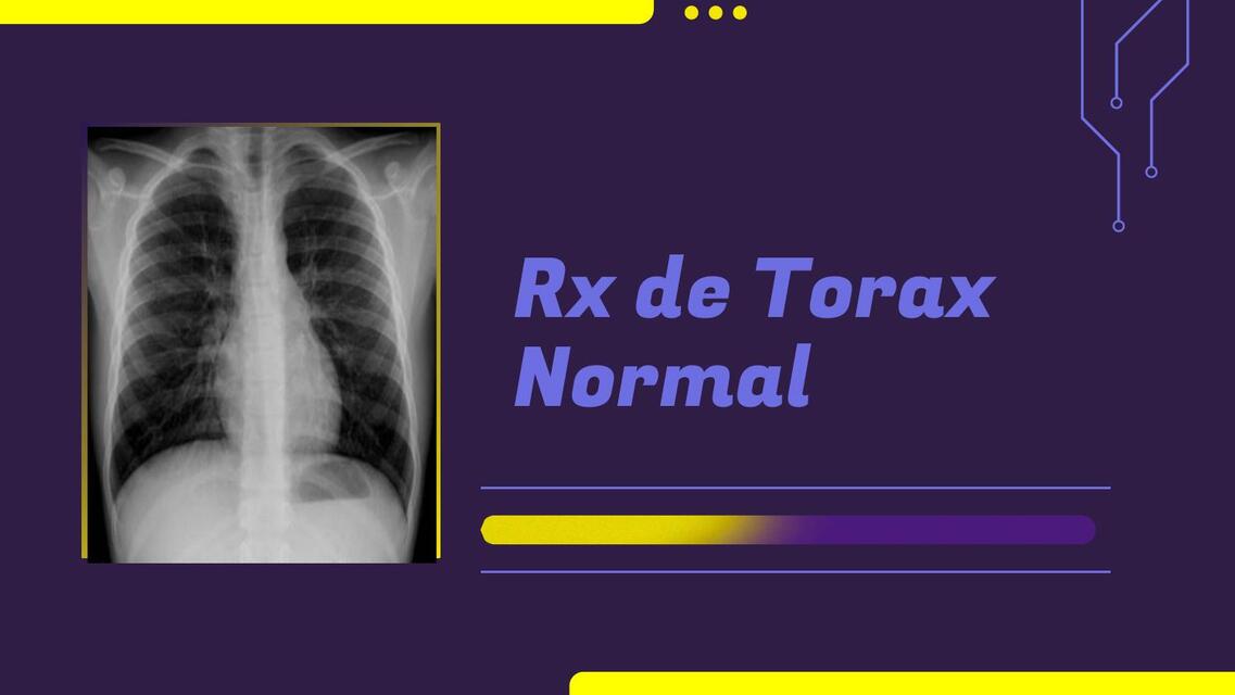 Rx Torax Normal | Jack. E | uDocz