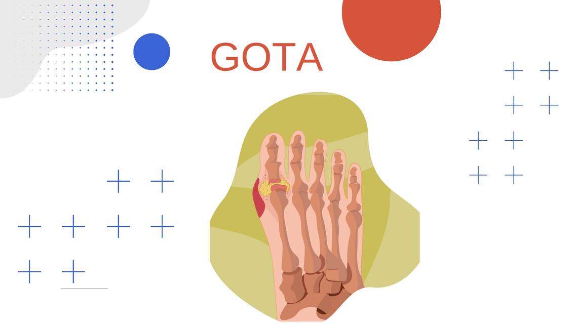 GOTA | Dr. Joel Meza | uDocz