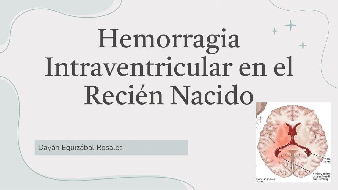 Hemorragia Intraventricular en el recién nacido | Dayan Eguizabal | uDocz