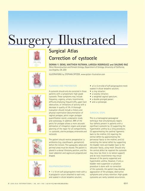 Flashcards de Correction of cystocele | Por PALOMO LÓPEZ | uDocz