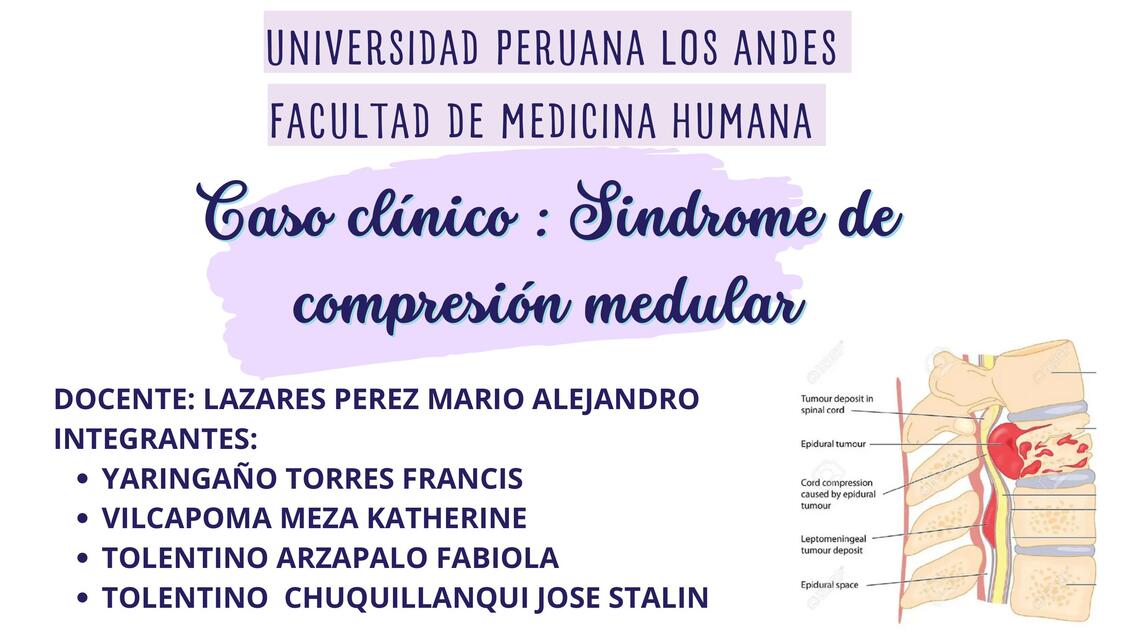 SINDROME DE COMPRESIÓN MEDULAR | FABIOLA | uDocz