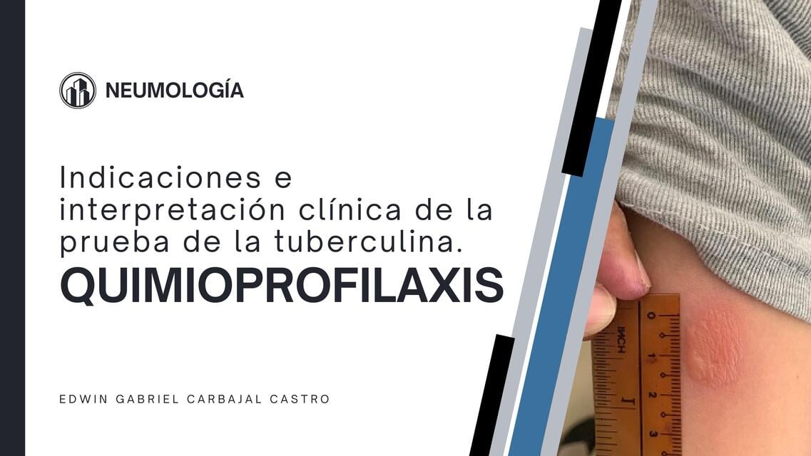 Indicaciones e interpretación clínica de la prueba de la tuberculina ...
