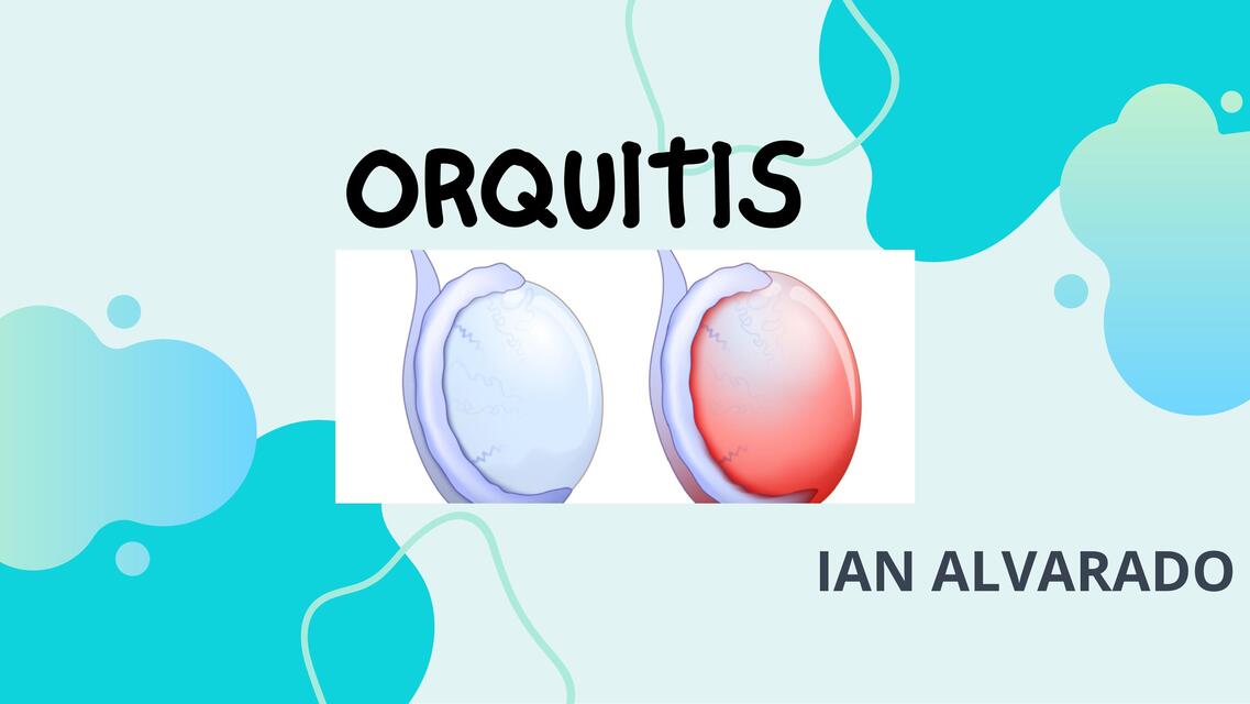 ORQUITIS PRESENTACION IAN ALVARADO | Ian Alvarado | uDocz