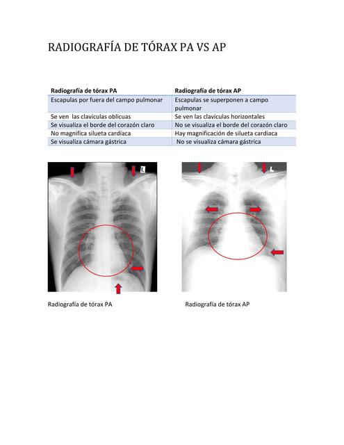 RADIOGRAFÍA DE TÓRAX PA VS AP | Jorge | uDocz