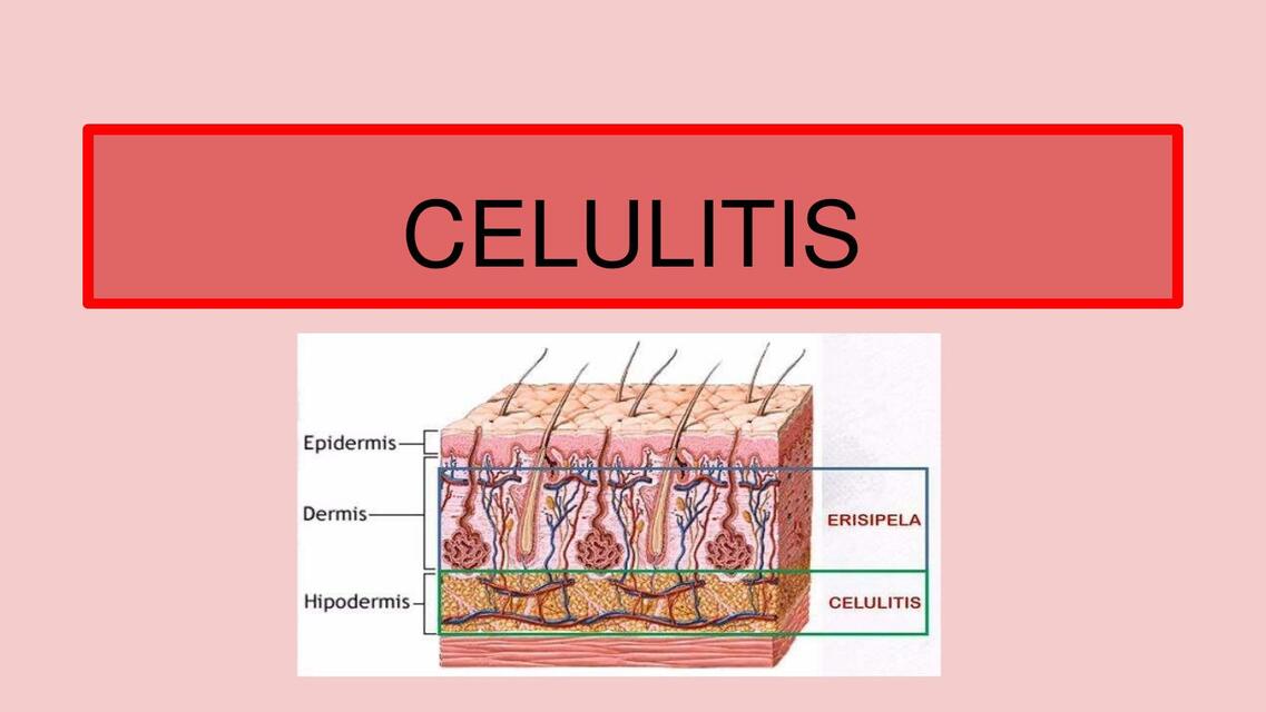 Celulitis y abcesos 1 | . | uDocz