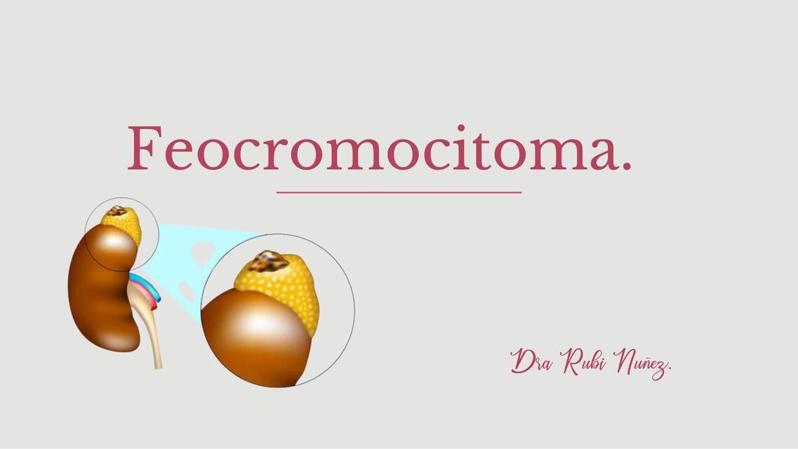 Feocromocitoma en Anestesiologia. | Rubí Núñez | uDocz