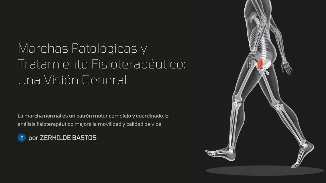 Marchas Patologicas y Tratamiento Fisioterapeutico | gabriela ruiz | uDocz