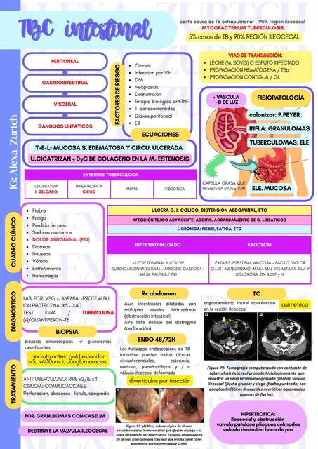 TBC INTESTINAL | Alexandra Crisostomo | uDocz