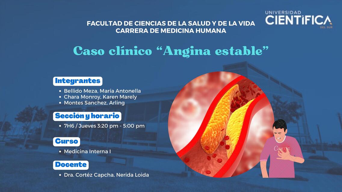 Caso clínico Angina estable | Daniel A. | uDocz