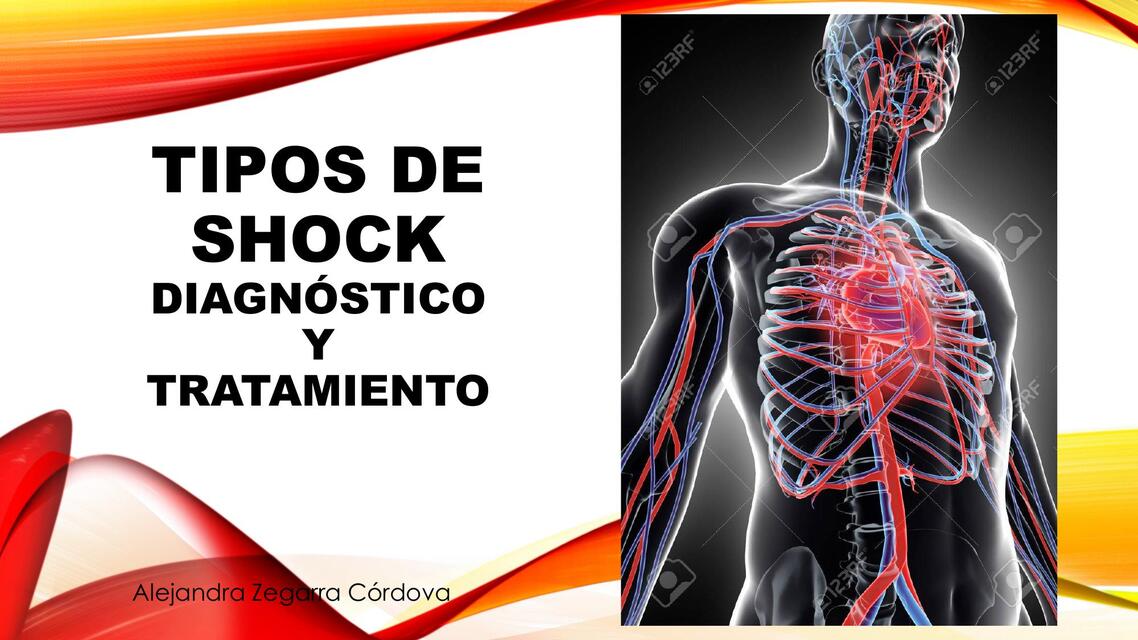 Flashcards de TIPOS DE SHOCK DIAGNoSTICO Y TRATAMIENTO 2 | Por María ...