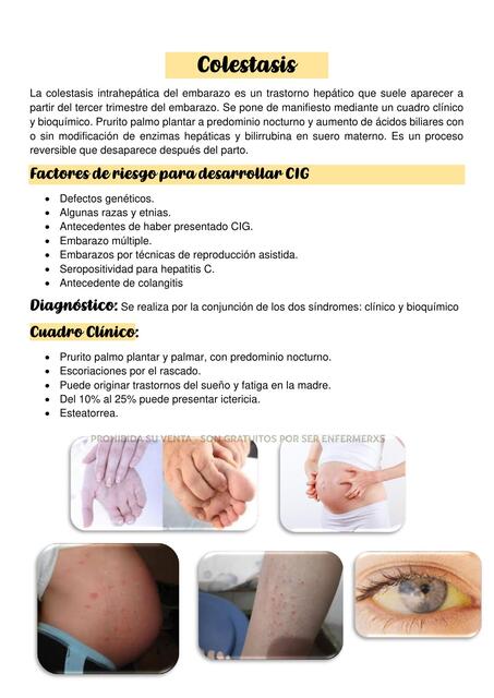 COLESTASIS INTRAHEPATICA GESTACIONAL | Kari Rodríguez | uDocz