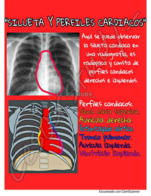 Silueta y perfiles cardíacos cesarstudy | Estudiante de medicina ...