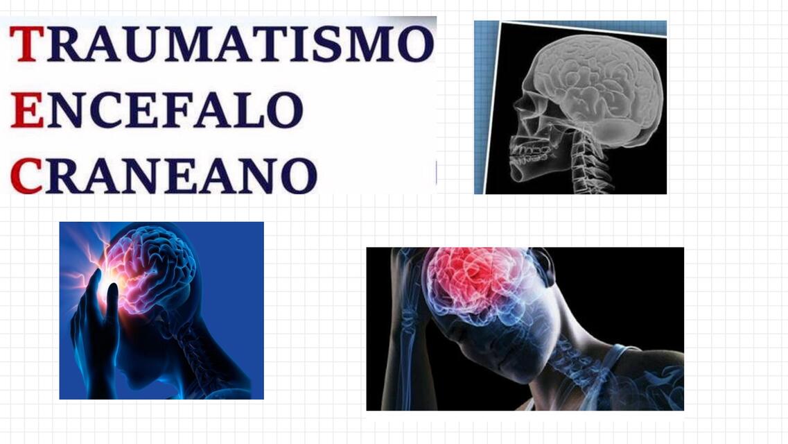 Flashcards de Traumatismo Encefalo Craneal | Por Wilder | uDocz