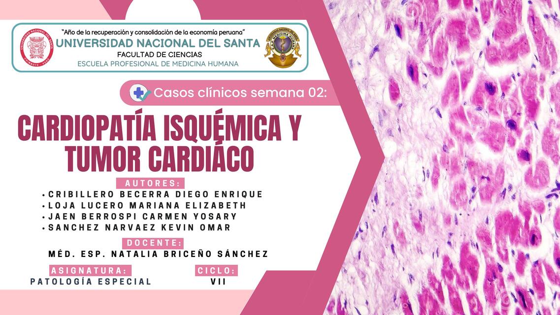 Flashcards de Cardiopatía isquémica y tumor cardiáco | Por Mariana Elizabeth Loja Lucero | uDocz