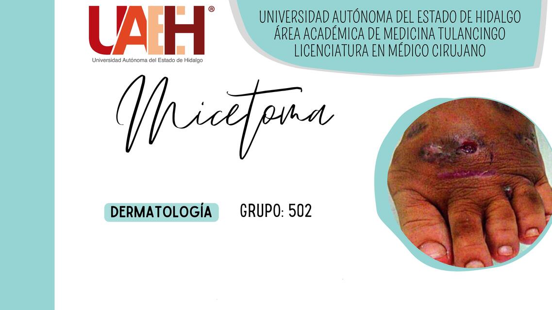 Micetoma - Dermatología | VAL M | uDocz