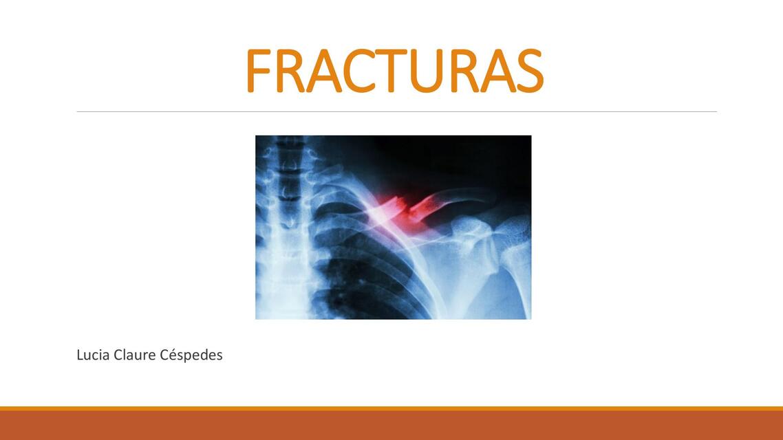 Fracturas | Noelía | uDocz