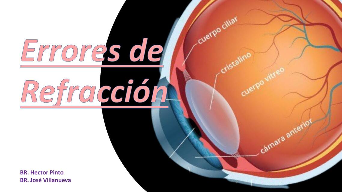 Errores de Refracción Def | Hector Luis Pinto Paez | uDocz