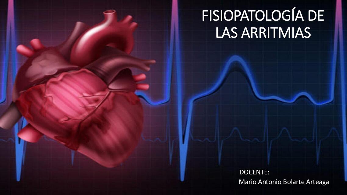 SESIÓN 05 ARRITMIAS 1 | Daniel Cerna | uDocz
