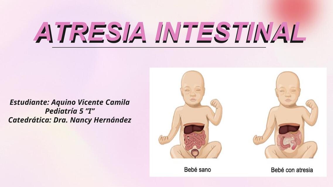 Atresia intestinal | Camila | uDocz
