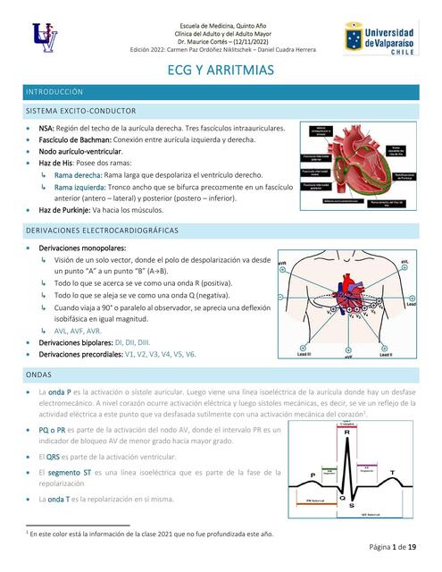 ECG y arritmias | MAGALY CLARA | uDocz