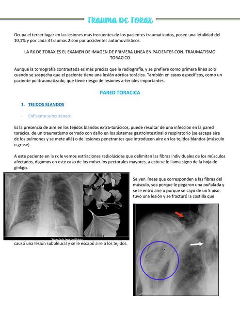 TRAUMA DE TORAX RX | GCR | uDocz