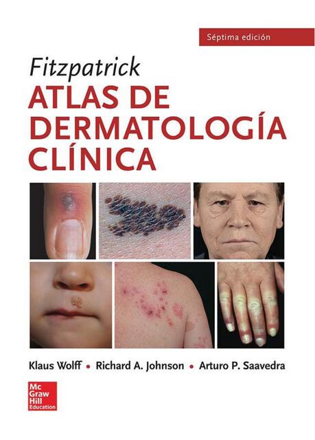 Atlas de dermatologia clinica Fitzpatrick 7ed | Miranda Zárate | uDocz