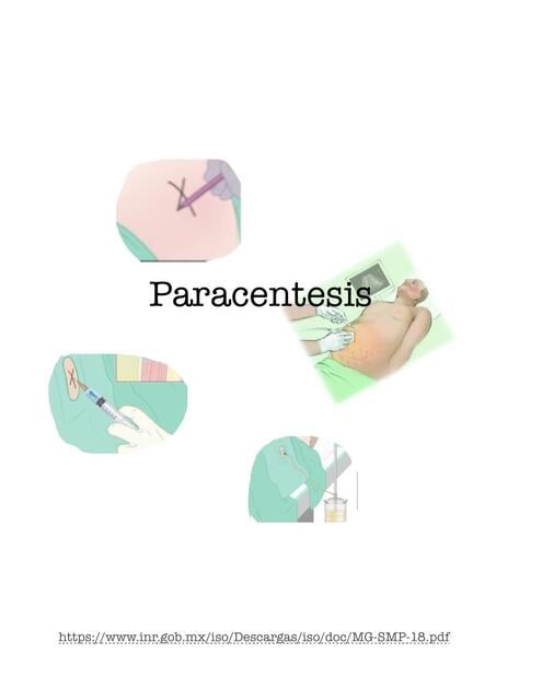 Procedimiento manual paracentesis | Biianni Itaiza Albiño Martinez | uDocz
