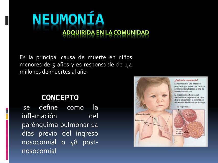 Neumonía | Yeider Ceballos | uDocz