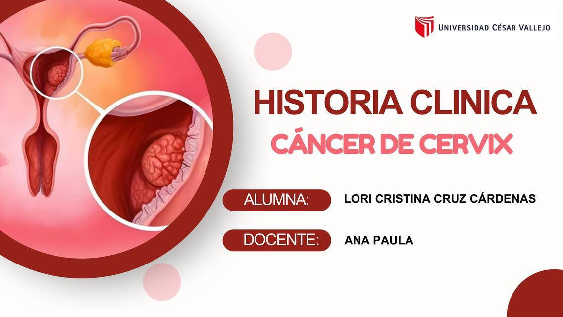 onco | LORI CRISTINA | uDocz