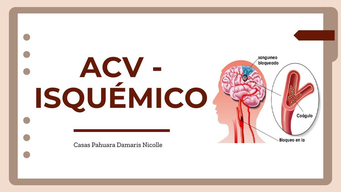 Flashcards de ACV ISQUEMICO | Por Damaris Casas Pahuara | uDocz