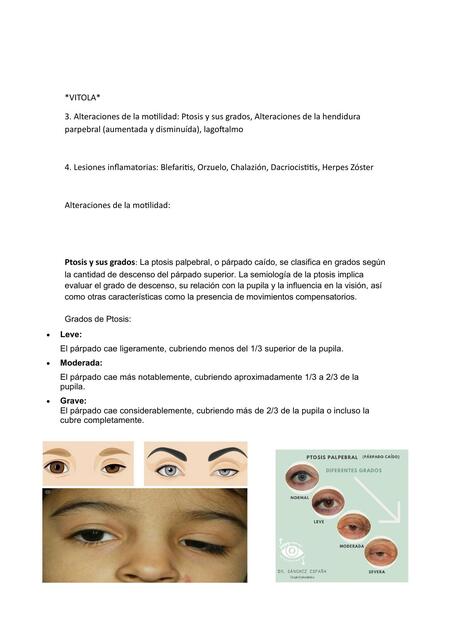 Flashcards de Documento 1 | Por Ana | uDocz