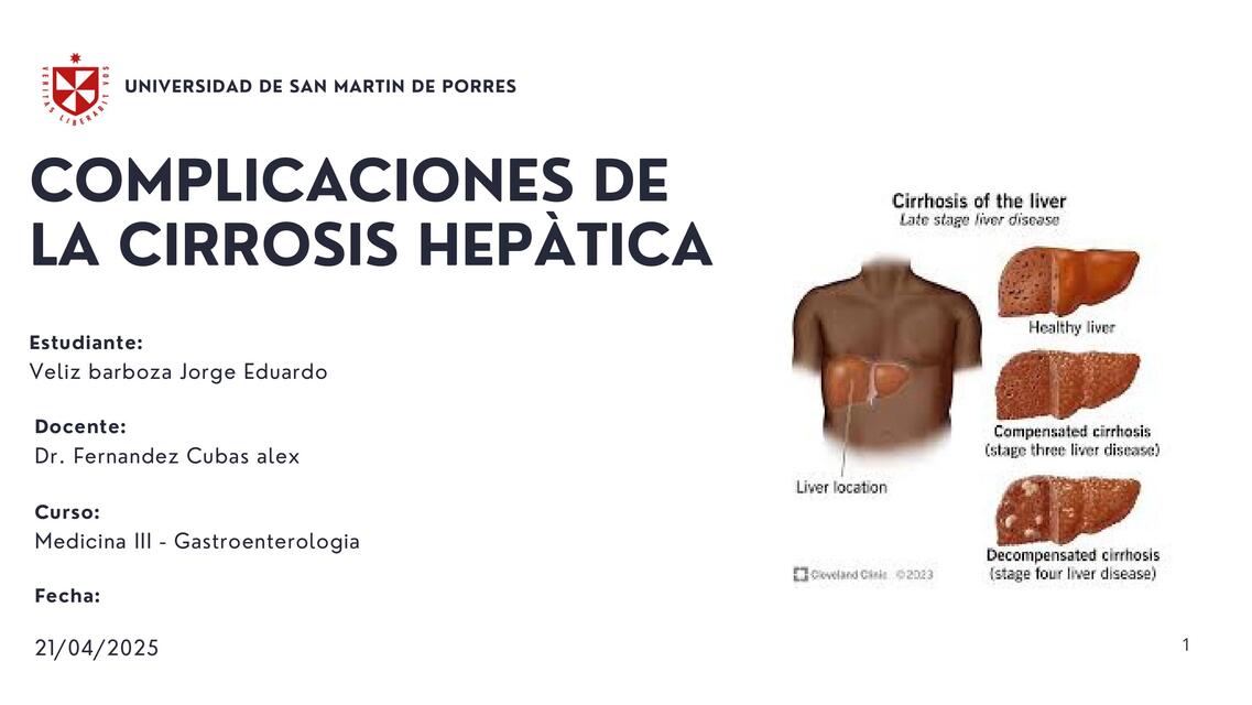 Complicacion de cirrosis hepática | Mizonamédica | uDocz