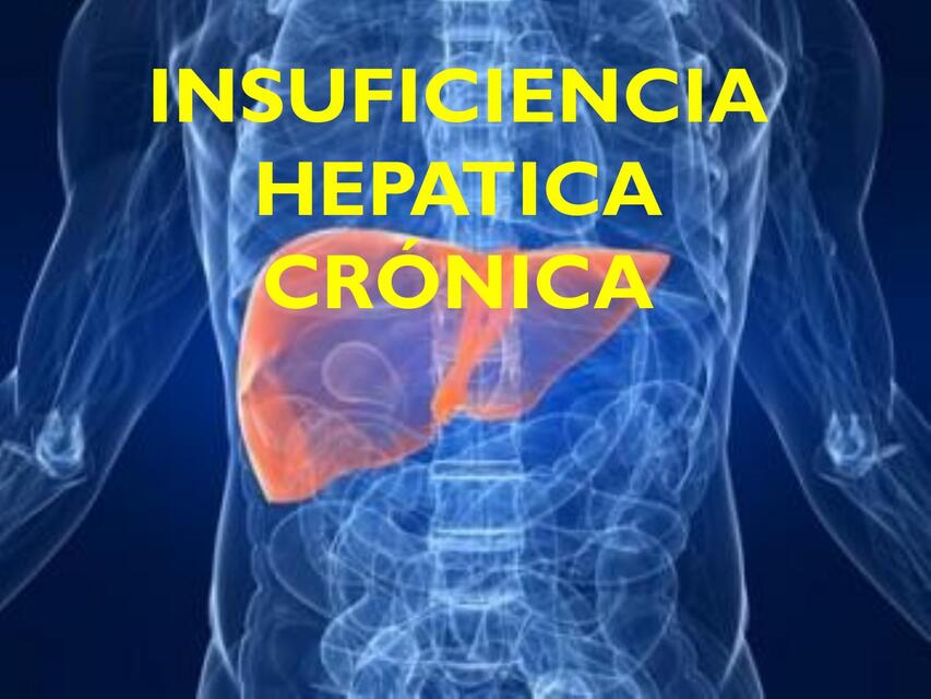 INSUFICIENCIA HEPATICA CRONICA | Maria Fernanda | uDocz