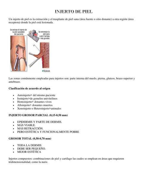 INJERTO DE PIEL | Willy FS | uDocz