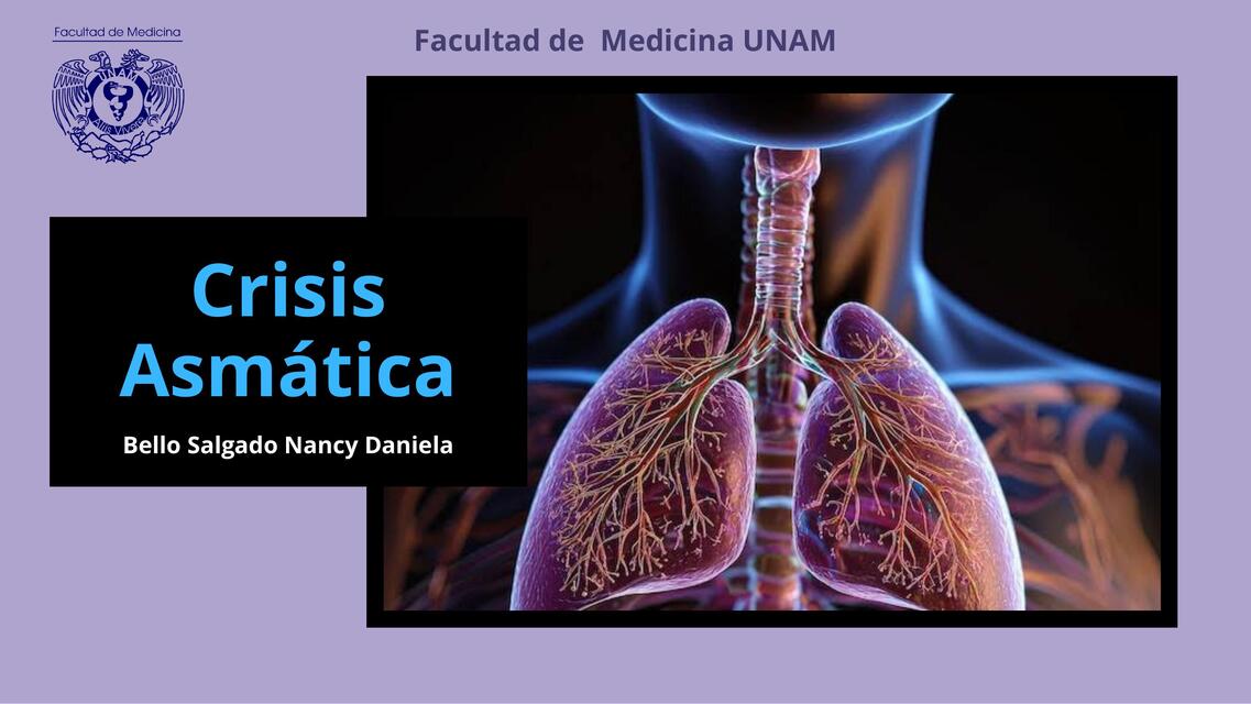 Crisis asmática | Nancy | uDocz