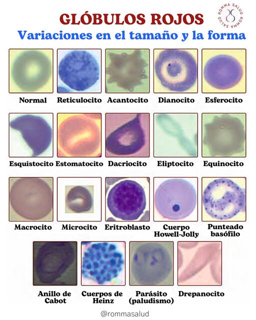 Variación del tamaño y forma de globulos rojos - interpretación | ROMMA ...
